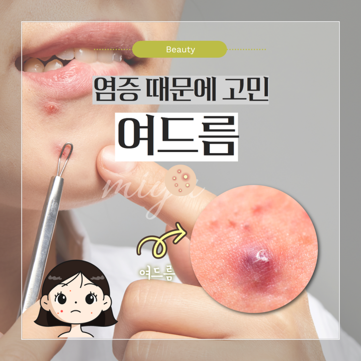 염증성 여드름 피부관리 갑자기 얼굴 코옆 코주변에 여드름 원인 네이버 블로그