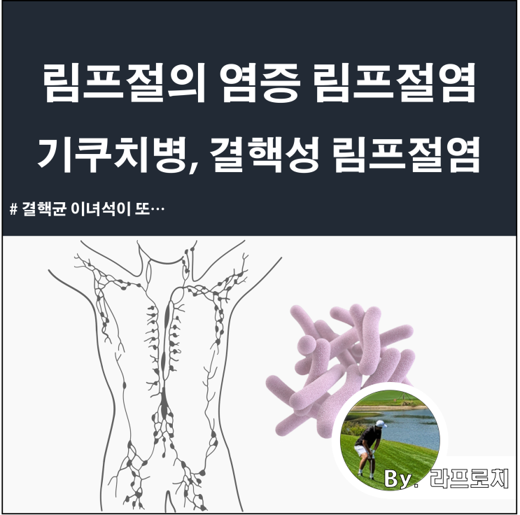 림프절염임파선염과 기쿠치병 증상 및 치료법 네이버 블로그
