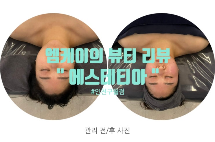 인천 구월동피부관리 에스테티아 윤곽관리 리뷰 : 네이버 블로그