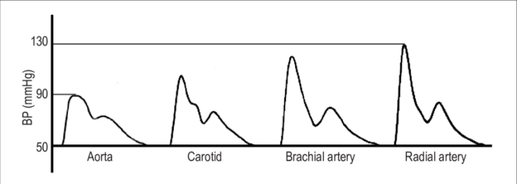 SCAI clinical expert consensus statement on the classification of ...