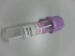 혈액 피 CBC검사 수치 개념 쉽게 알기 ESR PLT MPV PDW PCT : 네이버 블로그