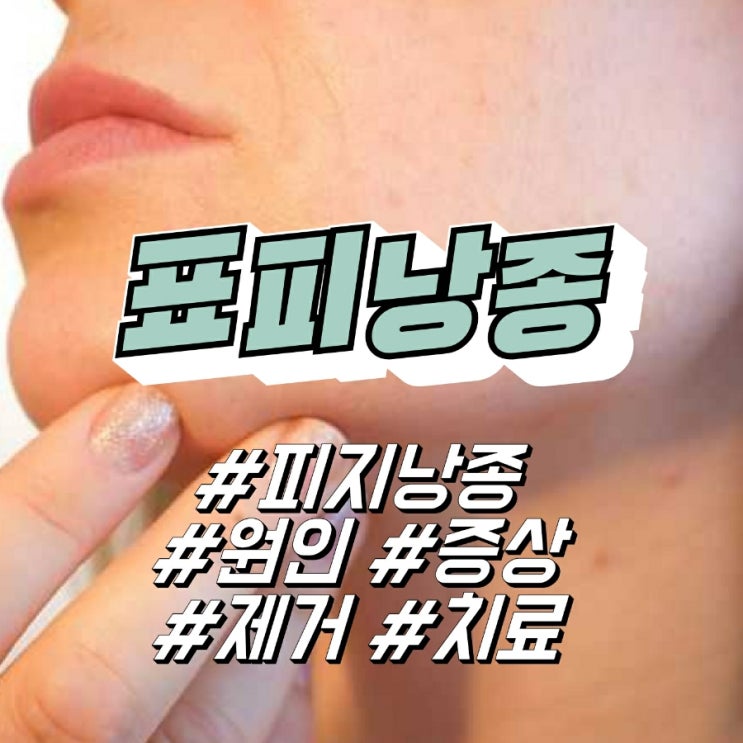 표피낭종 겨드랑이 피지낭종 원인 및 제거 수술 얼굴 귓볼 귀 두피 등 네이버 블로그