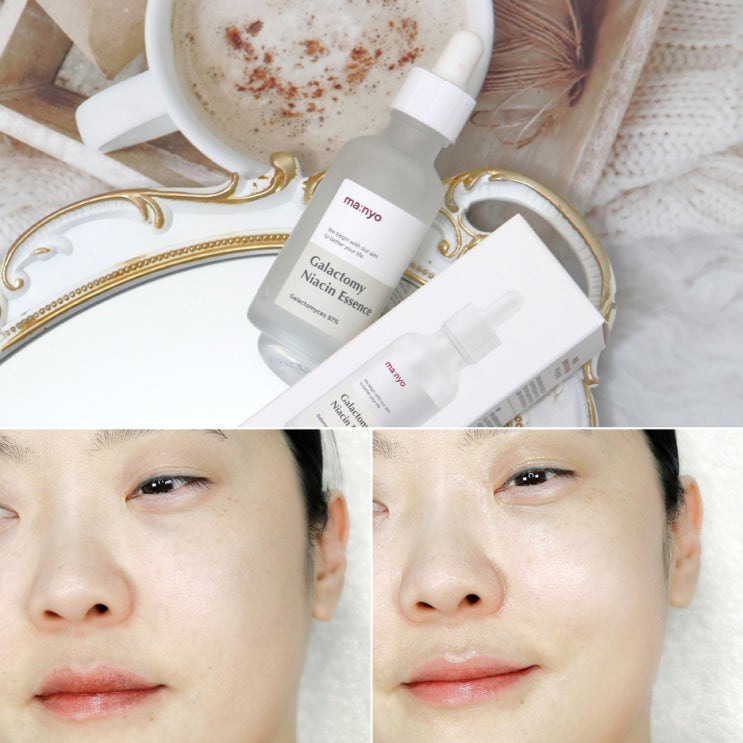 올리브영 에센스 추천템 피부미백 마녀공장 갈락토미 브라이트닝 에센스 네이버 블로그