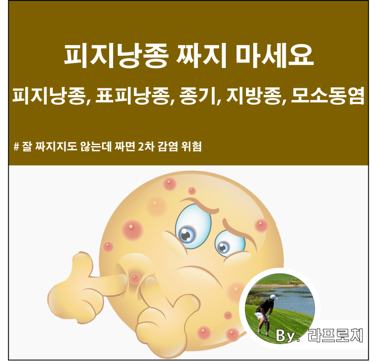 피지낭종 짜지마세요 표피낭종 피지낭종 원인과 제거 피지낭종 제거 후기 네이버 블로그