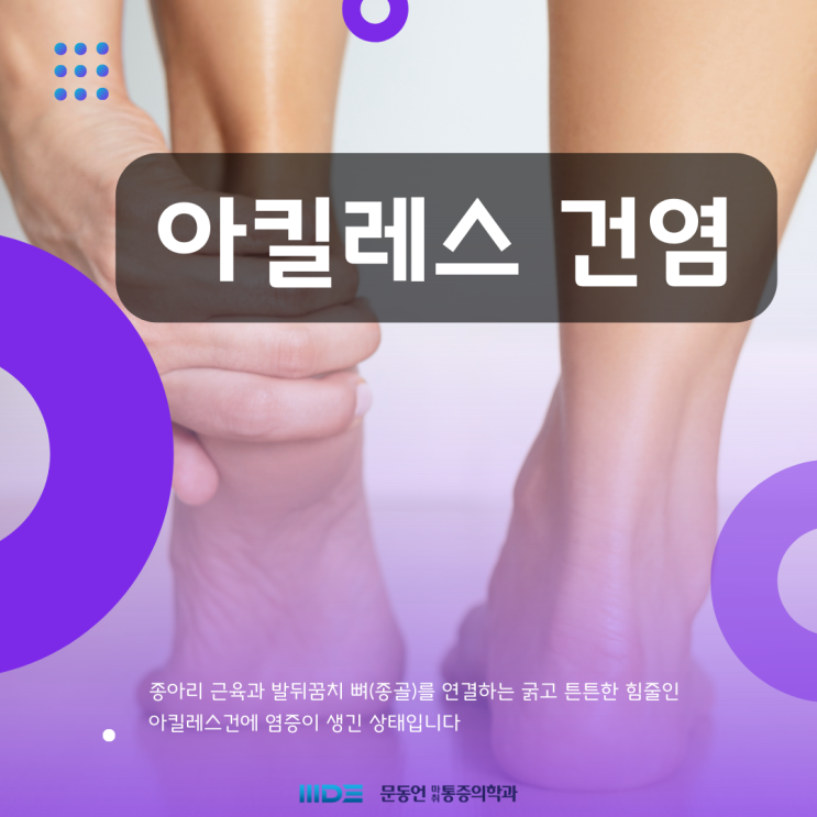 역삼역 발뒤꿈치 아킬레스건 통증 원인 및 증상 치료 아킬레스 건염 네이버 블로그