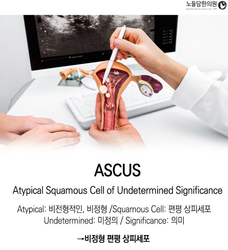 ASCUS 치료 시기 고민된다면 : 네이버 블로그