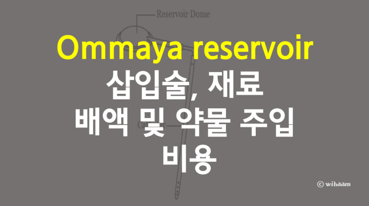 Ommaya reservoir (오마야 리저브) 삽입 수술료, 재료 비용, 삽입 후 수기료 : 네이버 블로그