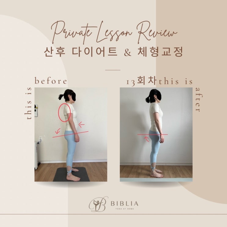 춘천 산후 체형교정 통증 조절 체중 감량 춘천방문홈요가필라테스 비비아요가앳홈 라운드숄더 어깨 통증 허리통증