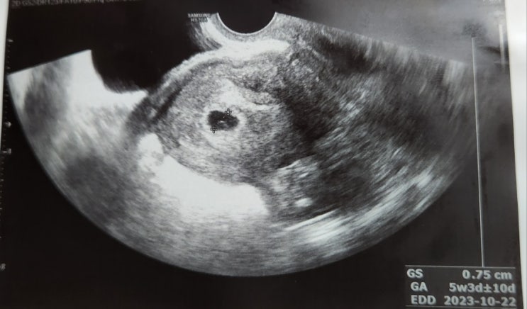 [5w3d] 반가워 뽁뽁이👶 : 네이버 블로그