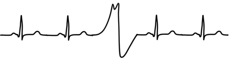 VPC EKG 모니터링 하는 법 : 네이버 블로그