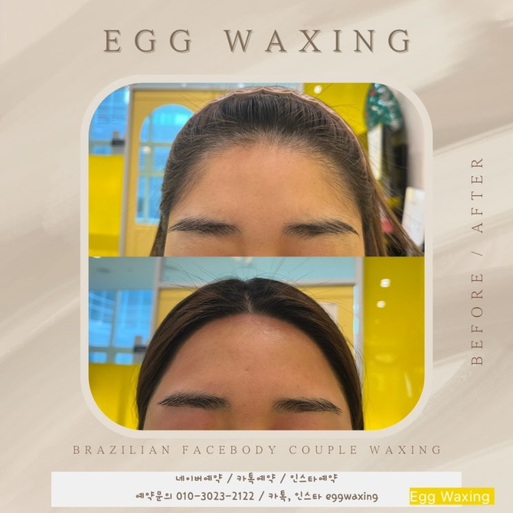 김포왁싱 / 구래동왁싱 / 여자헤어라인왁싱 / 페이스왁싱 : 네이버 블로그