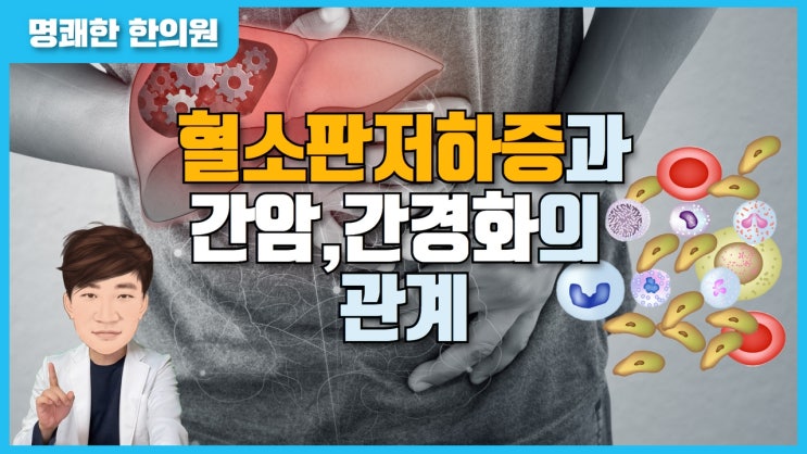 식도정맥류 출혈시 혈소판 수치는 지혈장애 원인 분석 Ft말기 간경화간암에서 나타나는 혈소판저하증 비장비대 비타민k
