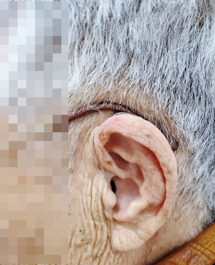 밀양보청기밀양독일보청기밀양시그니아독일보청기공식인정 전문센터~ 주위에서 말하는 소리를 거의 알아듣지를 못하시는 아버님~ㅠㅠ