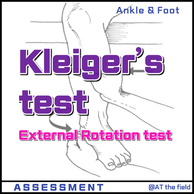 Kleiger’s test(external rotation test)/ 클레이거 검사/경비간인대, syndesmosis 검사 ...
