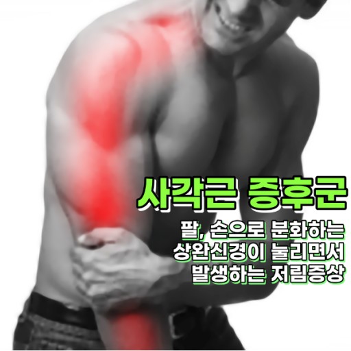 날개뼈 안쪽 심한 통증과 팔저림 증상의 원인 사각근 And사각근 스트레칭 및 사각근 치료방법 네이버 블로그