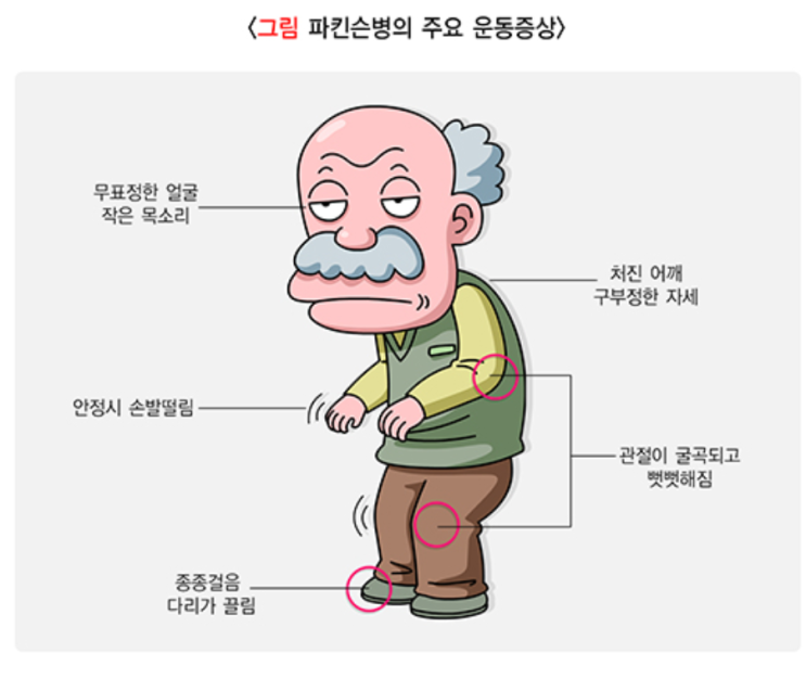 파킨슨병 1 정의 종류 원인 경과 예후 병태생리 역학 및 통계 네이버 블로그
