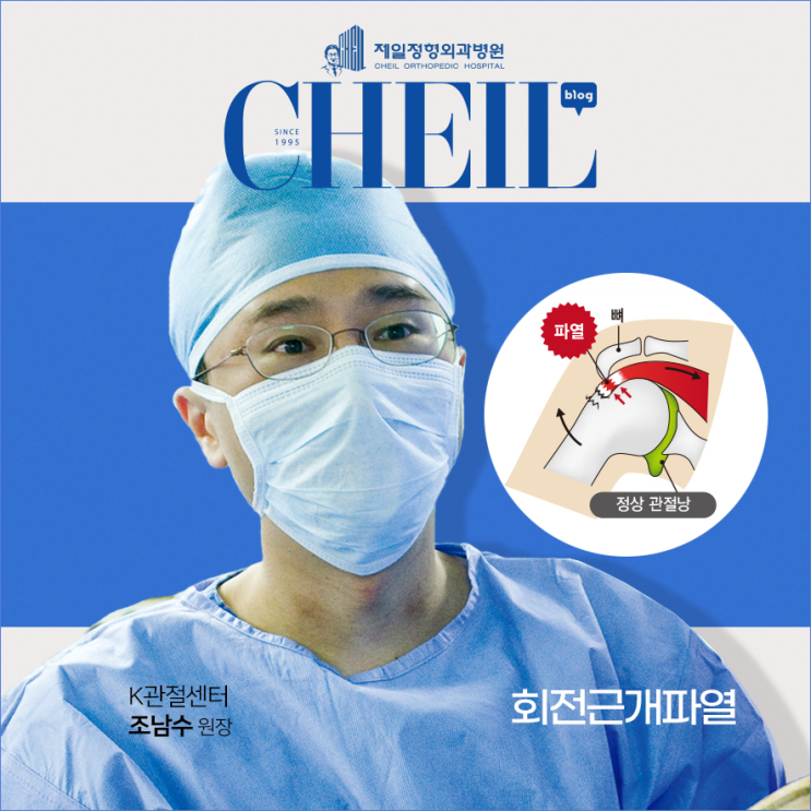 어깨 회전근개파열은 어떻게 치료하나요 Feat K관절센터 조남수 원장 네이버 블로그