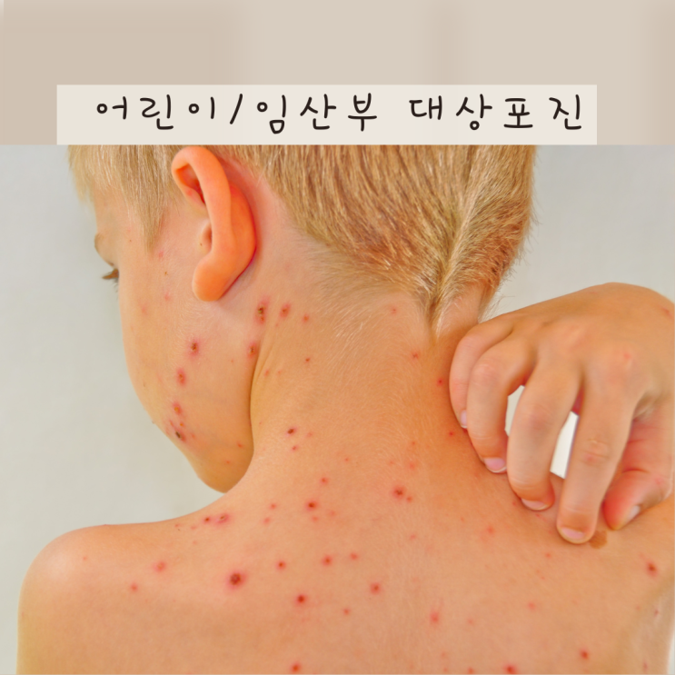 어린이 임산부 대상포진 원인 증상 치료 후 신경통 관리 알아볼까요 네이버 블로그