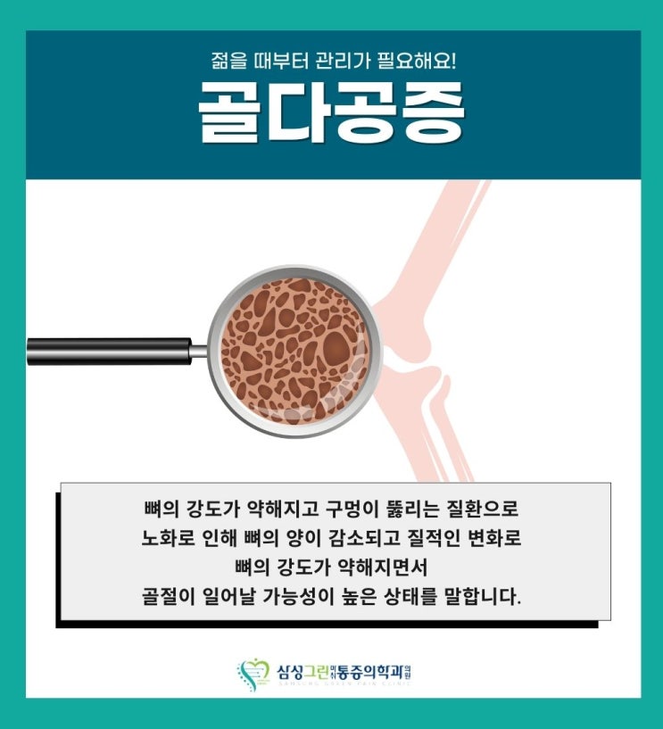 일산 마두 정형외과 골다공증 작은 충격에도 골절까지 이어질 수 있어 네이버 블로그