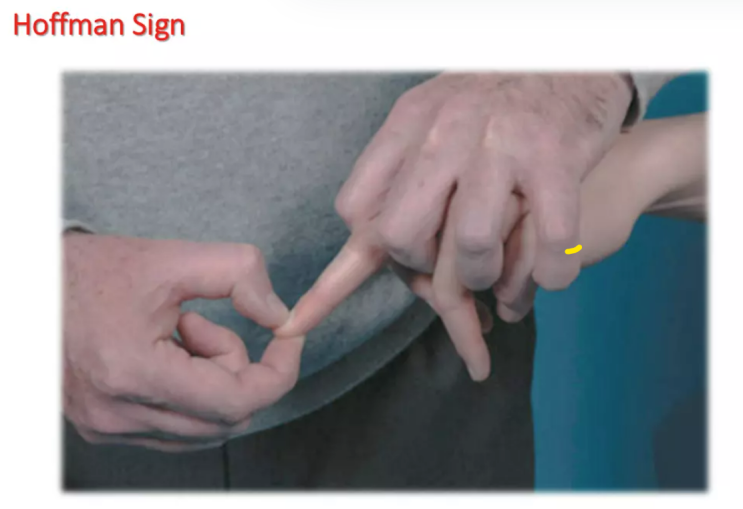 검사법 1. 호프만 징후 검사 Hoffmann's sign : 네이버 블로그