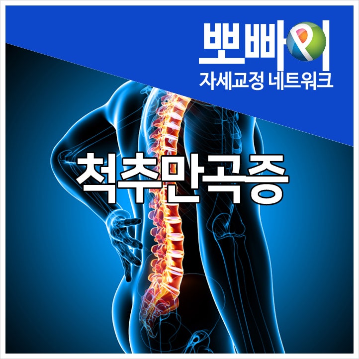 척추만곡증 유발로 인한 허리등통증 치료 네이버 블로그