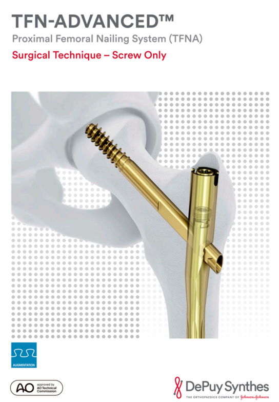 Fx-Intertrochanteric Fx., CR/IM nailing - AO TFNA or PFNA : 네이버 블로그