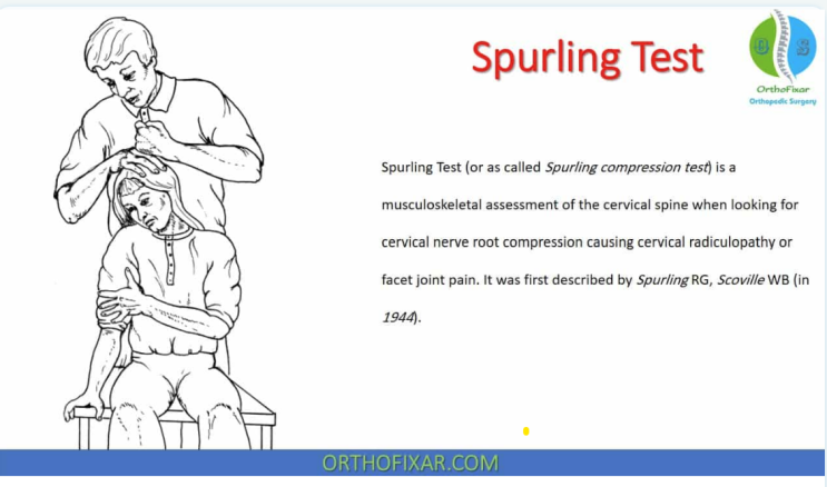 검사법 3. Spurling test 스펄링 테스트 목디스크 자가진 : 네이버 블로그