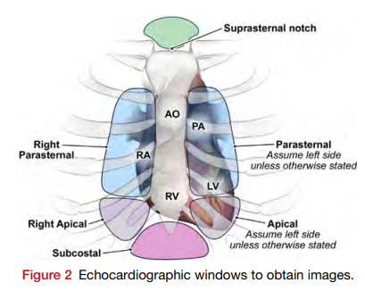심장초음파(TTE) 2D 영상_apical, subcostal, suprasternal notch window : 네이버 블로그