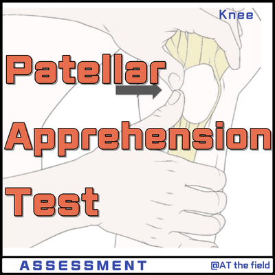 Patellar Apprehension Test / patella disloscation / 슬개대퇴증후군, 슬개골 탈구 ...