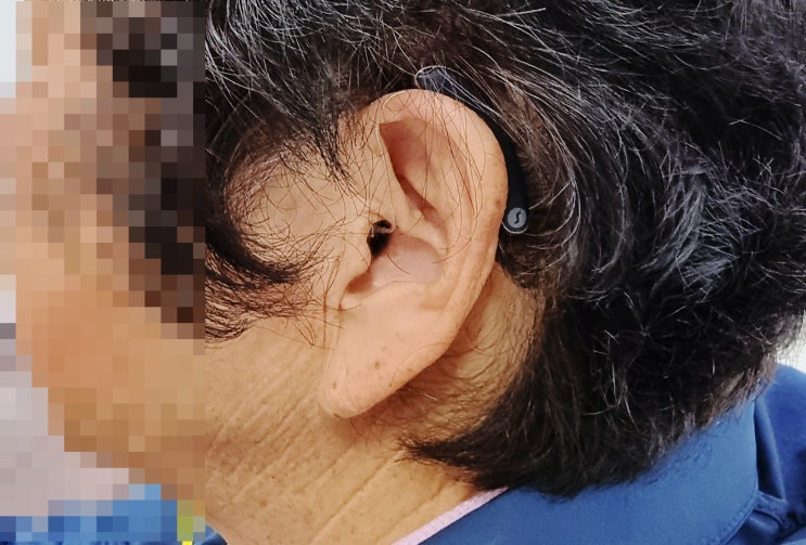 밀양보청기밀양독일보청기밀양시그니아독일보청기공식인정 전문센터~ 보청기 구입하신지 5년이 지나서 최신형 보청기로 재구매하신