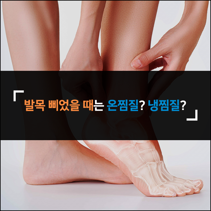발목염좌 발목삐었을때찜질 발목부었을때 발목접질렀을때 서울신정형외과 네이버 블로그