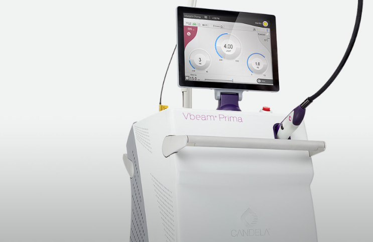 [CANDELA 공식대리점] V Beam Prima_브이빔프리마 : 네이버 블로그