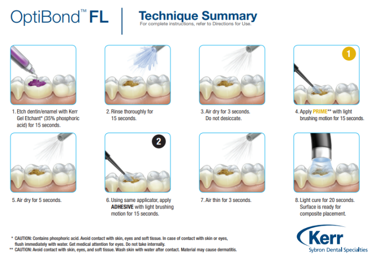 Optibond FL, 3-step etch and rinse의 표준 : 네이버 블로그