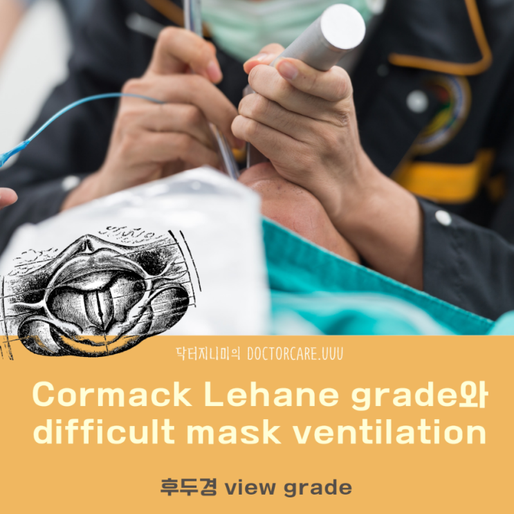 Cormack Lehane grade와 후두 시야를 확보하는 방법. : 네이버 블로그