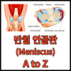 반월 연골판 A To Z 반월 연골판meniscus 구조기능역할파열수술재활 반월상연골판 파열손상 기전증상
