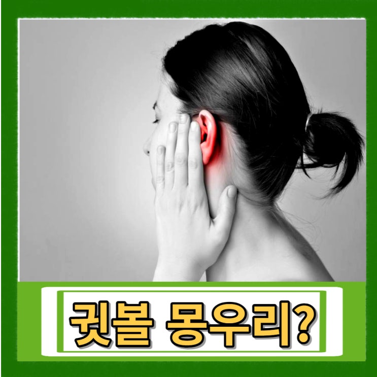 귓볼 몽우리 귀뒤 피지낭종 표피낭종 여드름 염증 부음 고름 통증 병원 치료 체크해요 네이버 블로그
