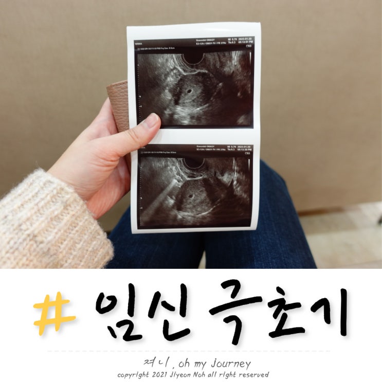 임신 극초기증상 3주차 4주차 5주차 병원 가는 시기와 아기집 볼 수 있는 시기 임신일기 네이버 블로그