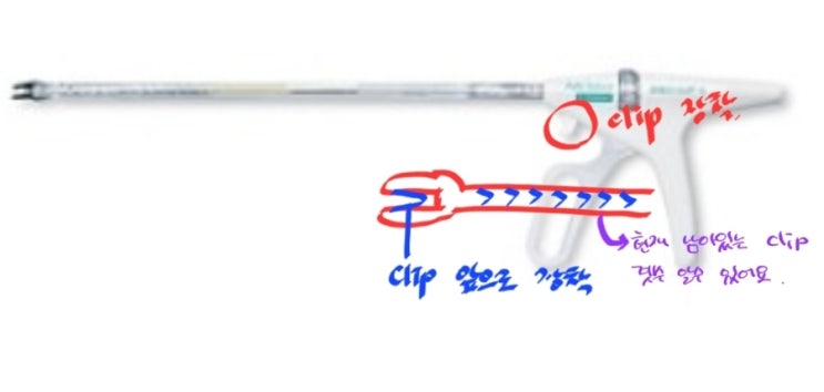 외과 GS 스크럽 -복강경수술 (Laparoscopy) 기본 endo clip , Hemolock : 네이버 블로그