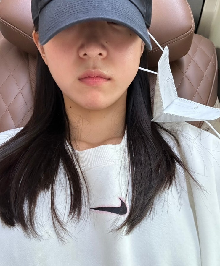 사랑이아프니에서 사랑니 발치 후기 네이버 블로그