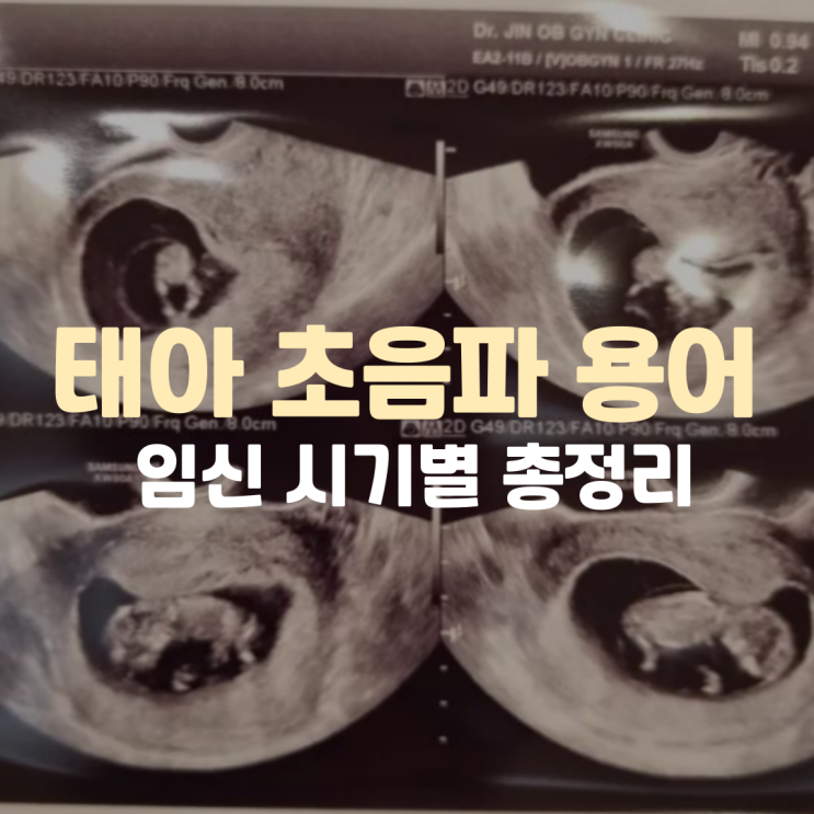 태아 초음파 용어, 임신 시기별 총정리 (CRL, GA, EDD, EFW, BPD, HC, AC, FL 등) : 네이버 블로그