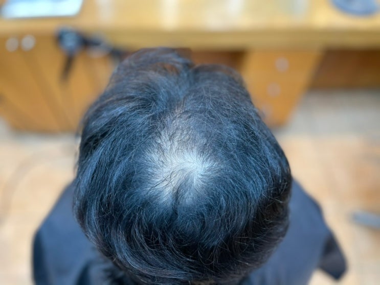 하남자에서 상남자로 남자탈모성형펌 부산유일무이탈모전문사상르네시떼헤어 덕포주례감전하단김해가야동래양산연산연지장전명륜대연양정서면