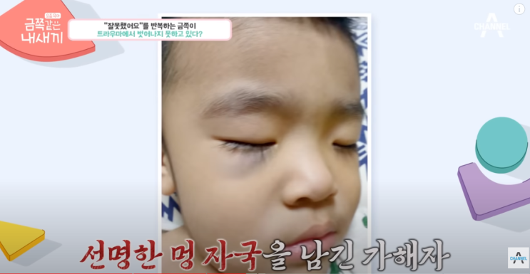 금쪽같은 내새끼10월 7일 방영아동학대 트라우마청각적 주의력adhdptsd외상후스트레스장애산만한아이 네이버 블로그