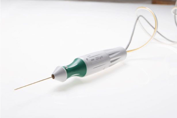 유리체 절제술(vitrectomy) : 네이버 블로그