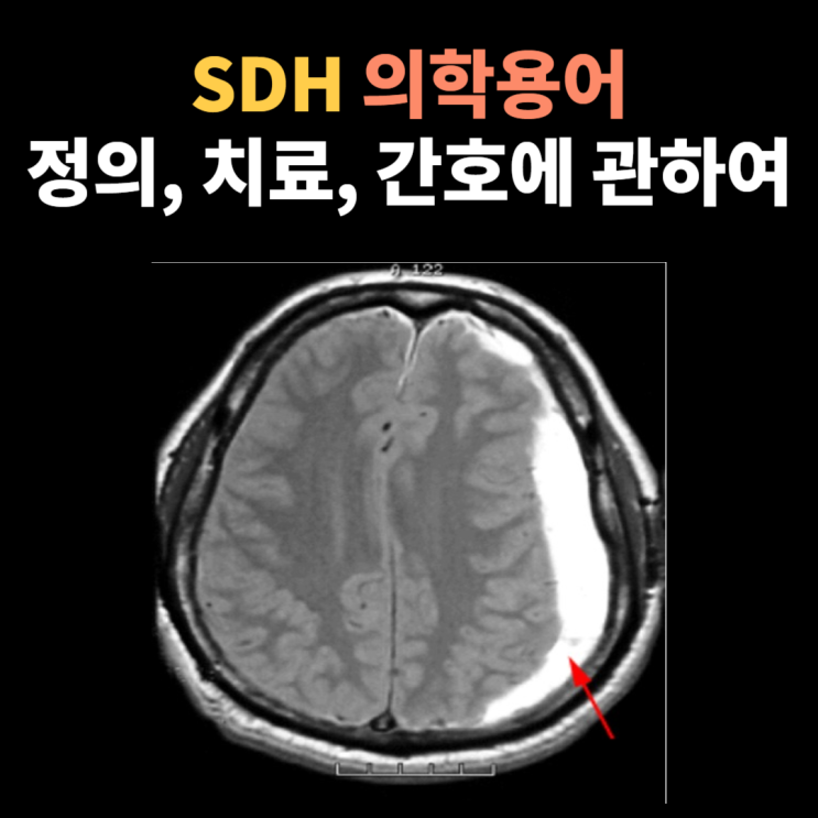 의학용어 SDH 정의, 간호, 치료법에 대하여 알아봐요~ : 네이버 블로그