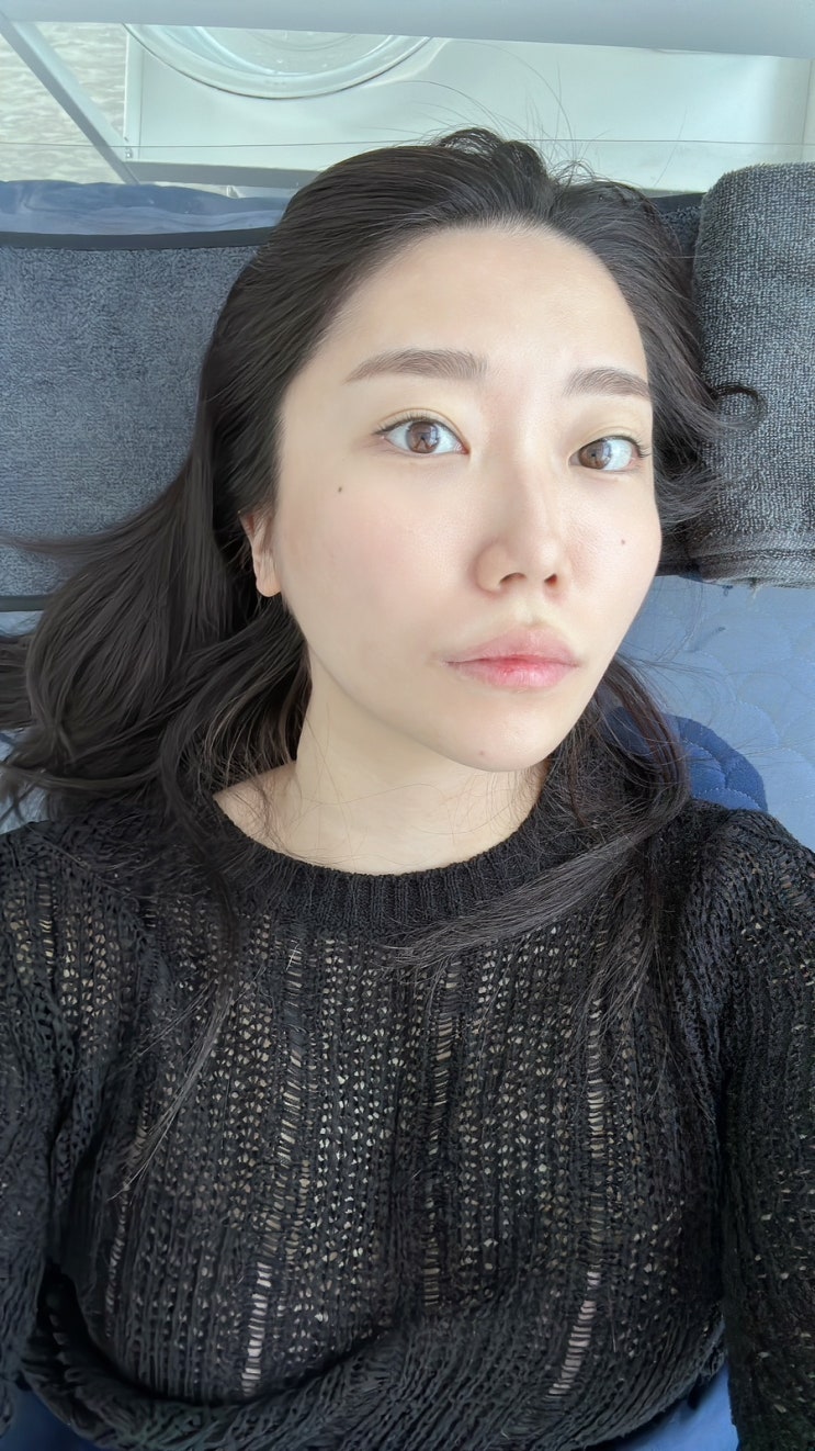 대구피부관리 봉덕동피부관리 대구압출잘하는 스킨클라우드 스킨퓨전이브 후기 네이버 블로그