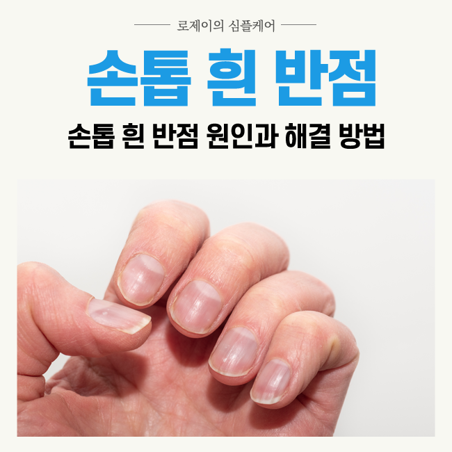 손톱 흰반점 왜 생길까 원인과 해결 방법 네이버 블로그