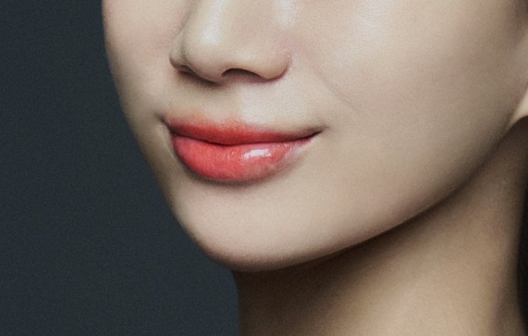 입술필러 가격 커스텀입술필러로 얇은 입술 고민 해결한 한달차 리얼후기 선릉역 피부과 네이버 블로그