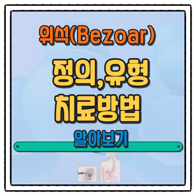 위석(bezoar)의 정의, 유형, 치료방법 알아보기 : 네이버 블로그