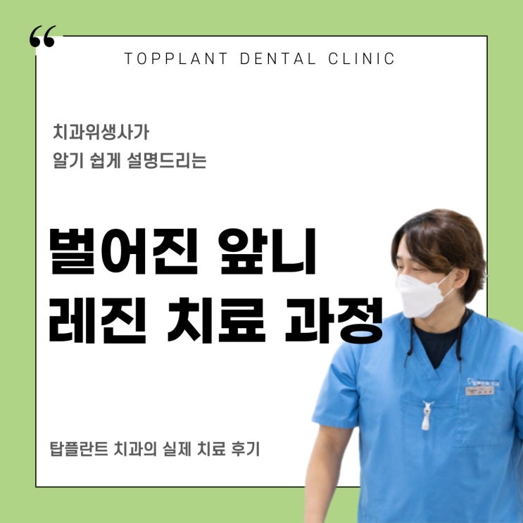 벌어진 앞니 레진 치료 레진으로 당일 치료 완료 성남 수진역 탑플란트치과 실제 치료 후기 네이버 블로그