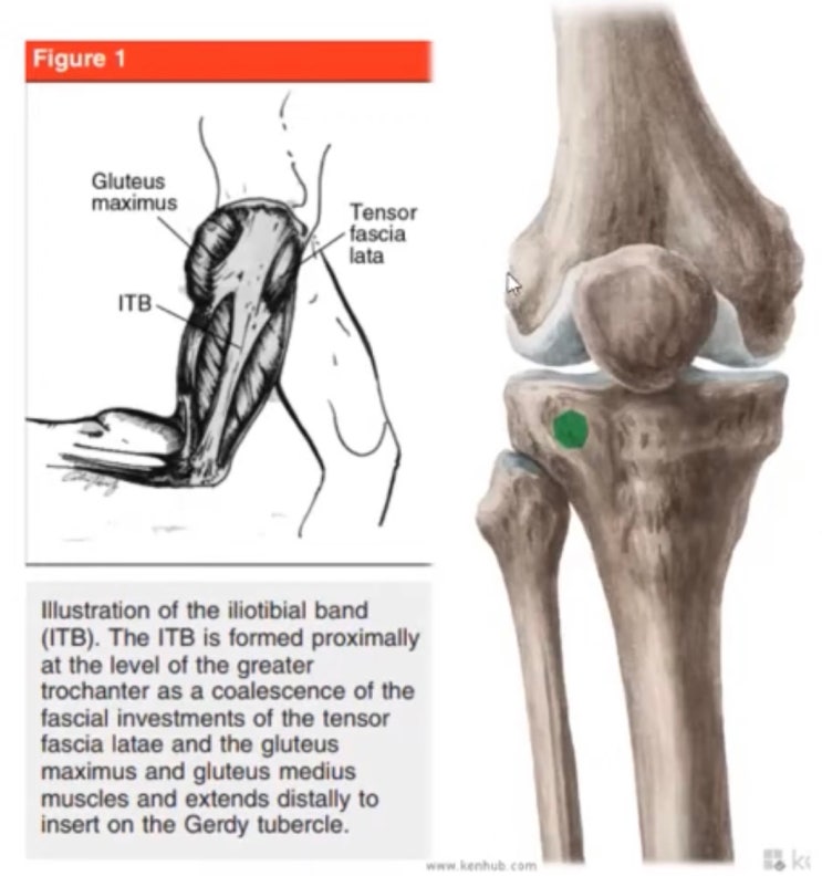 장경인대 증후군iliotibial Band Syndrome1 무릎 바깥쪽 통증 네이버 블로그